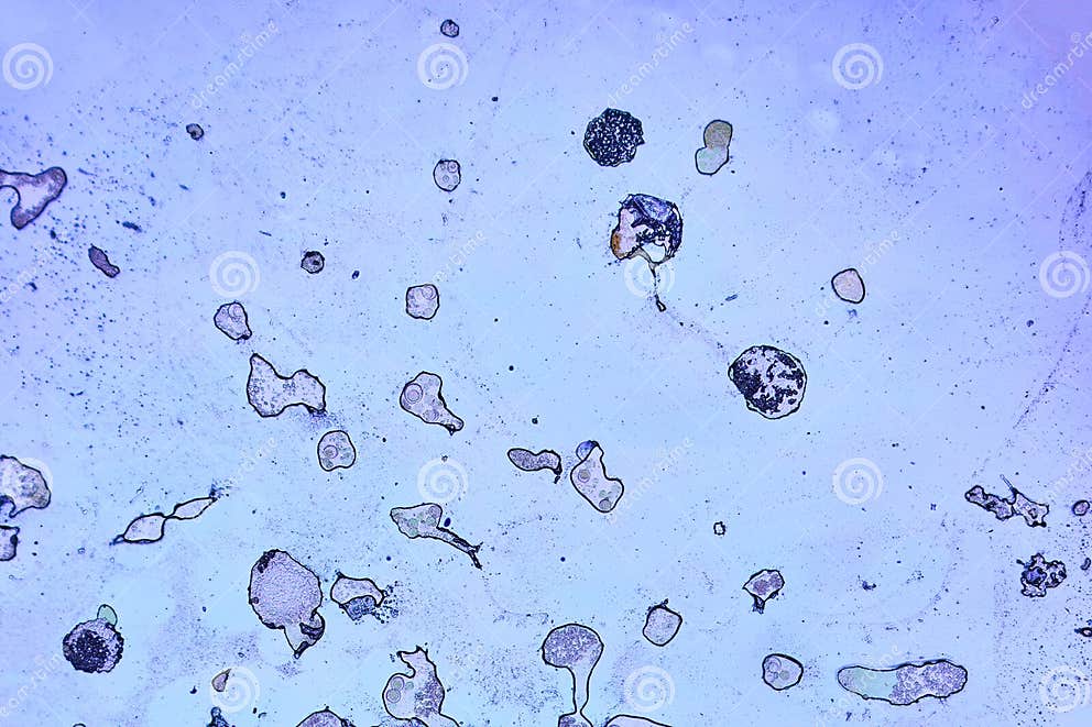 Life under a microscope stock image. Image of microorganism - 309095379