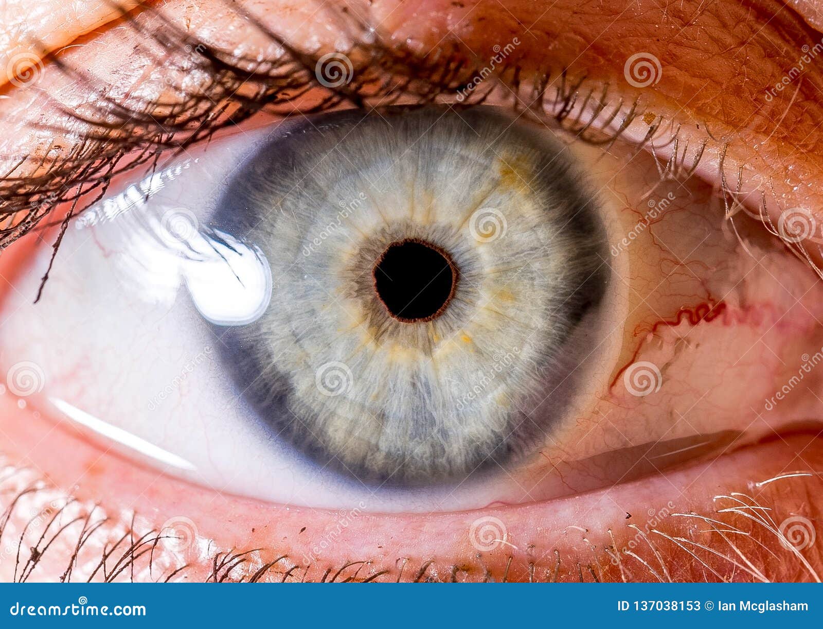 Close Up Eye. Close Up Iris. Very Close Macro Shot of an Eyeball Stock ...