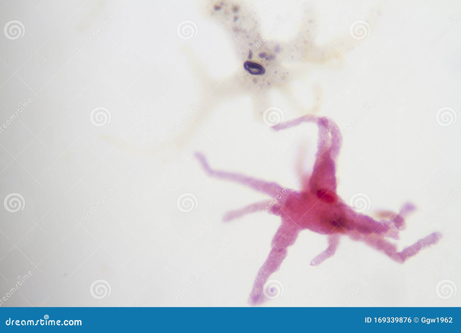 Amibe photo stock. Image du microbiologie, maladie, vacuole - 169339876