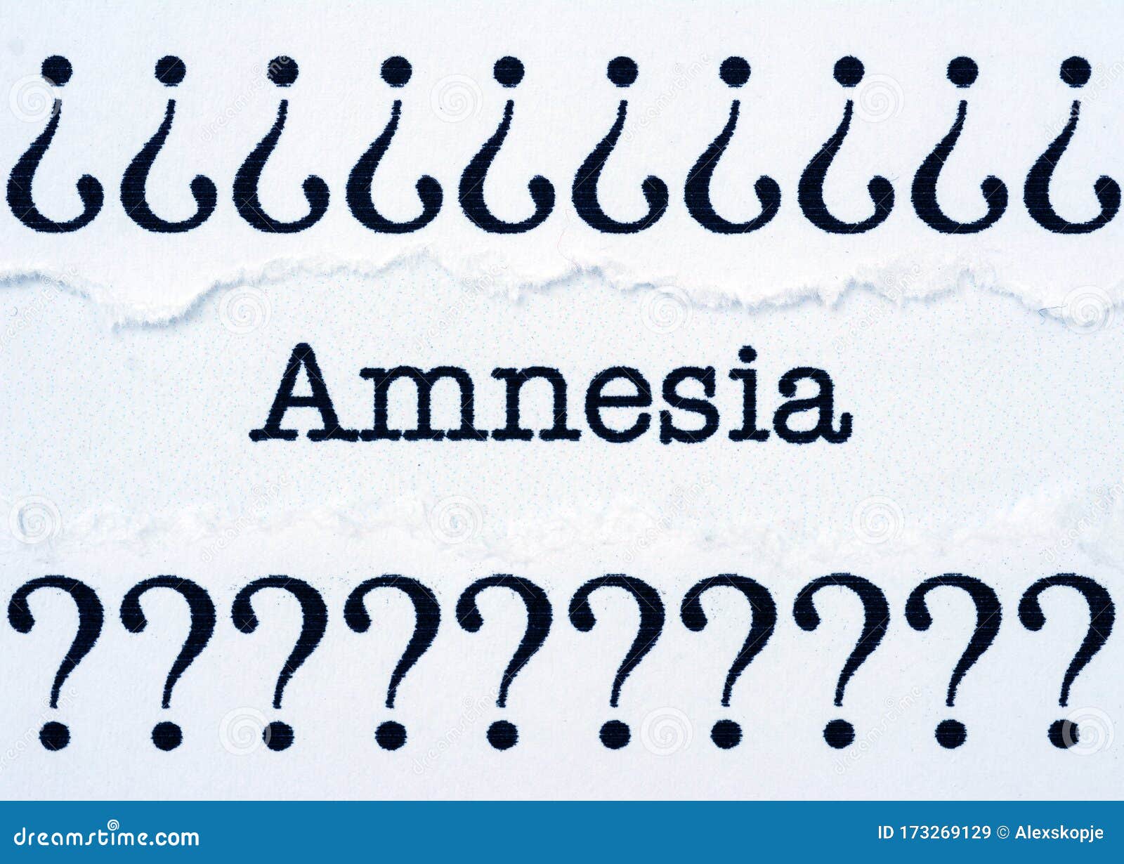 Amnesia causes and types - mumutours
