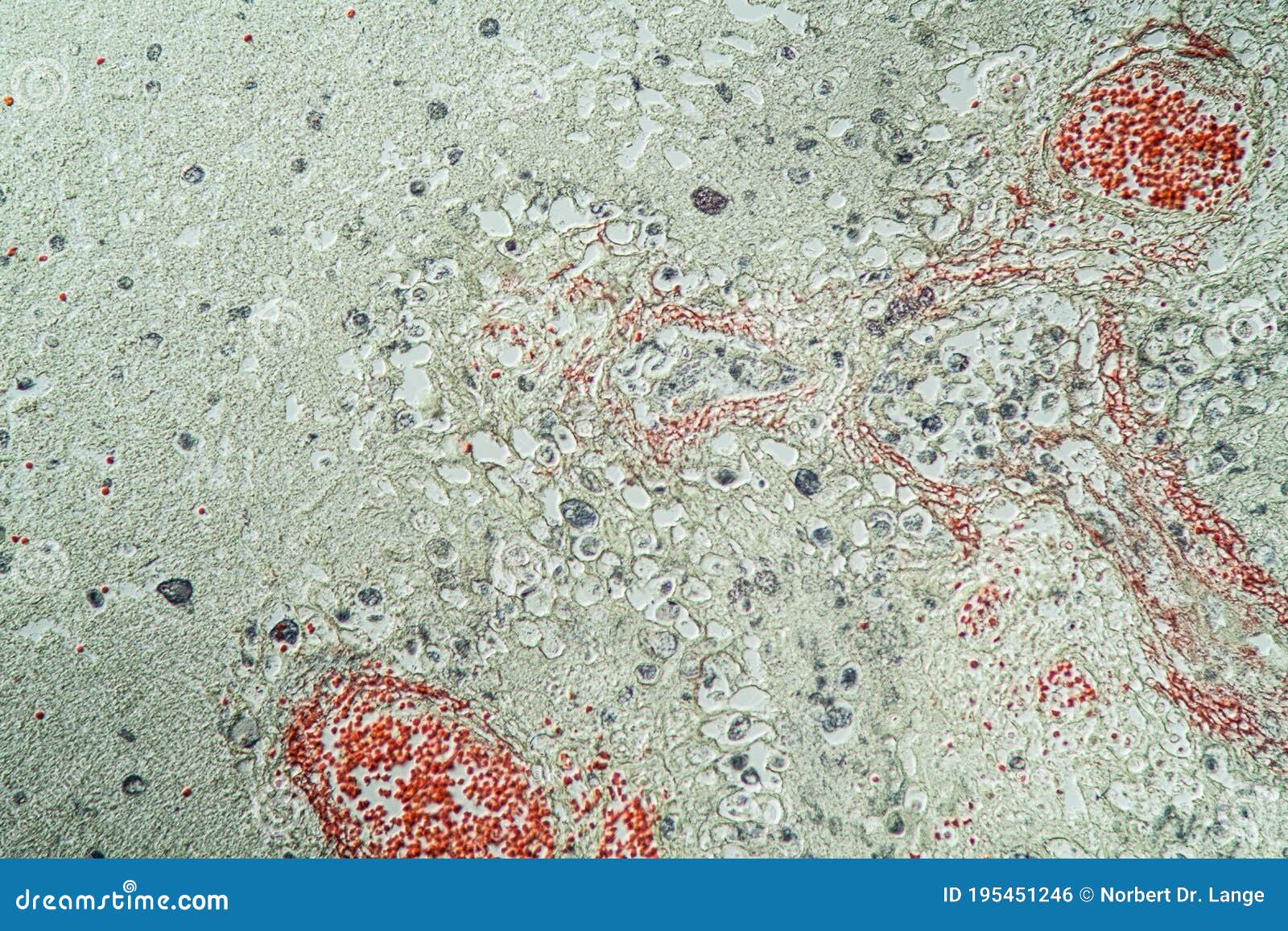 Amoeba Parasite Tissue Under the Microscope Stock Photo - Image of ...