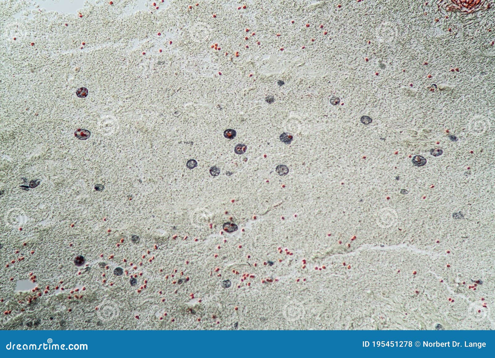 Amoeba Parasite Tissue Under the Microscope Stock Photo - Image of 200x ...