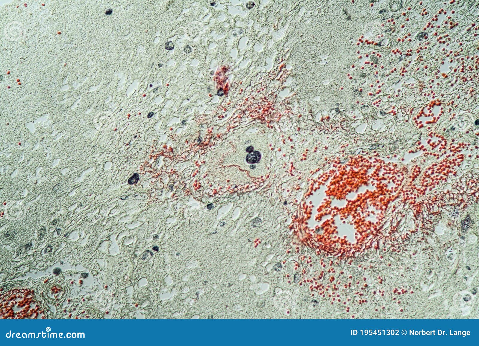 Amoeba Parasite Tissue Under the Microscope Stock Photo - Image of ...