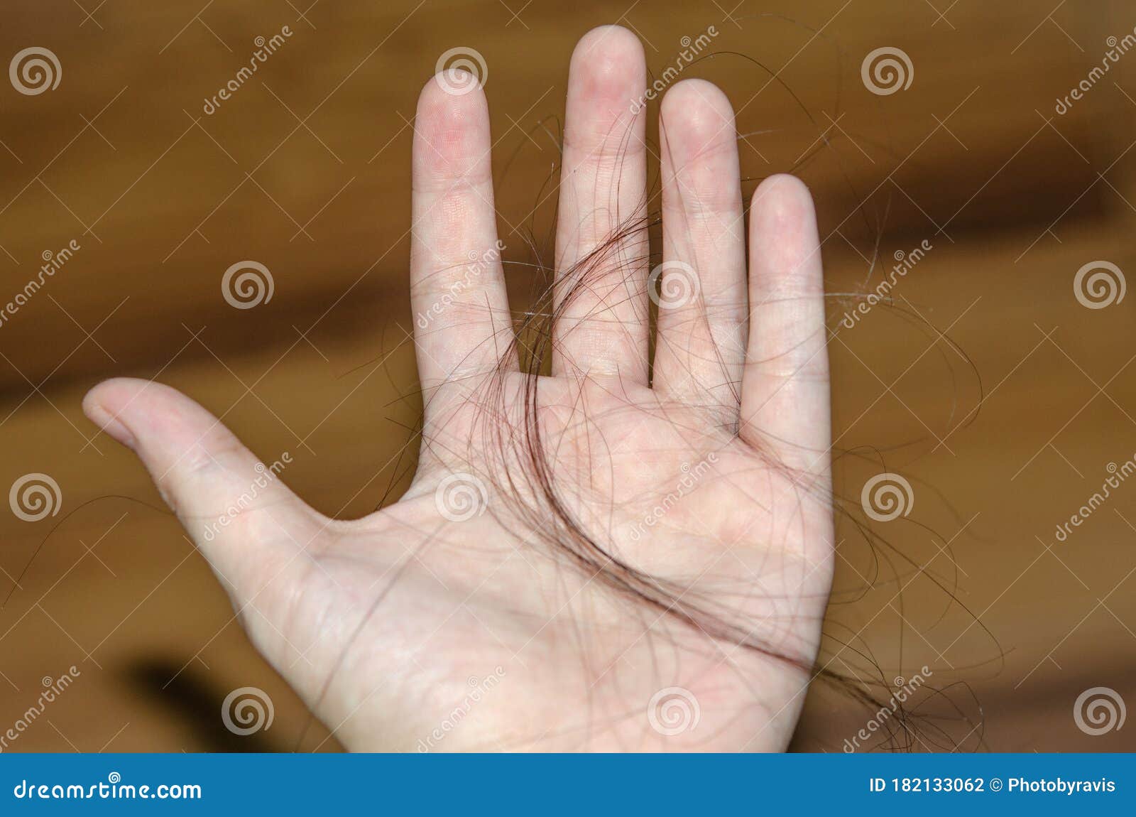 Hair falling on hand stock photo. Image of condition - 182133062