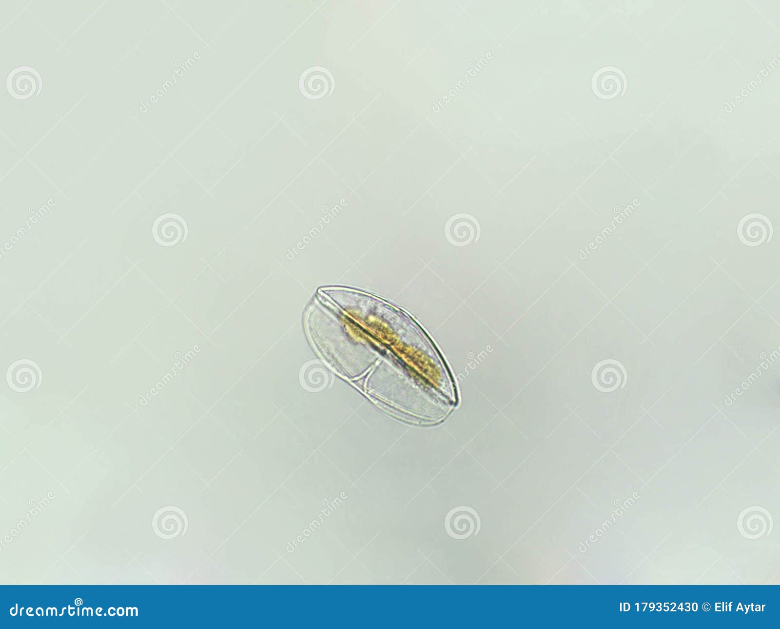 Amphora Sp. Algae Under Microscopic View Stock Photo - Image of genus ...