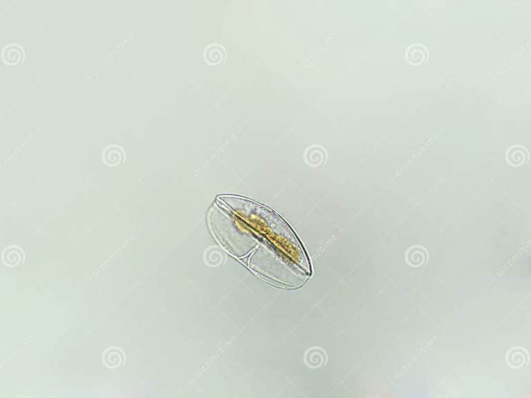 Amphora Sp. Algae Under Microscopic View Stock Photo - Image of genus ...