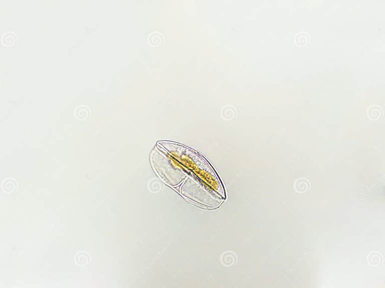 Amphora Sp. Algae Under Microscopic View Stock Photo - Image of macro ...