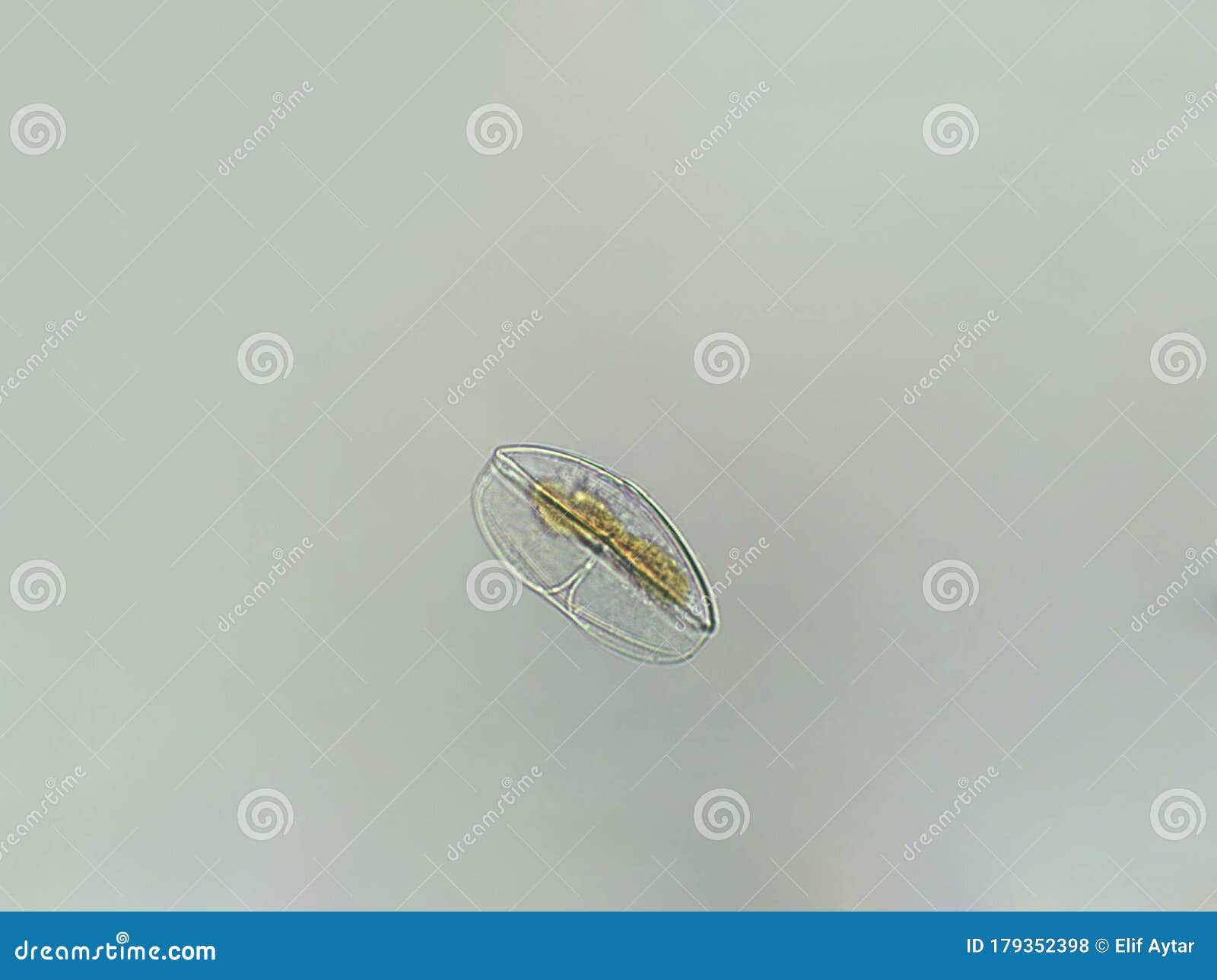 Amphora Spp.. Algen Onder Microscopisch Beeld Stock Foto - Image of ...