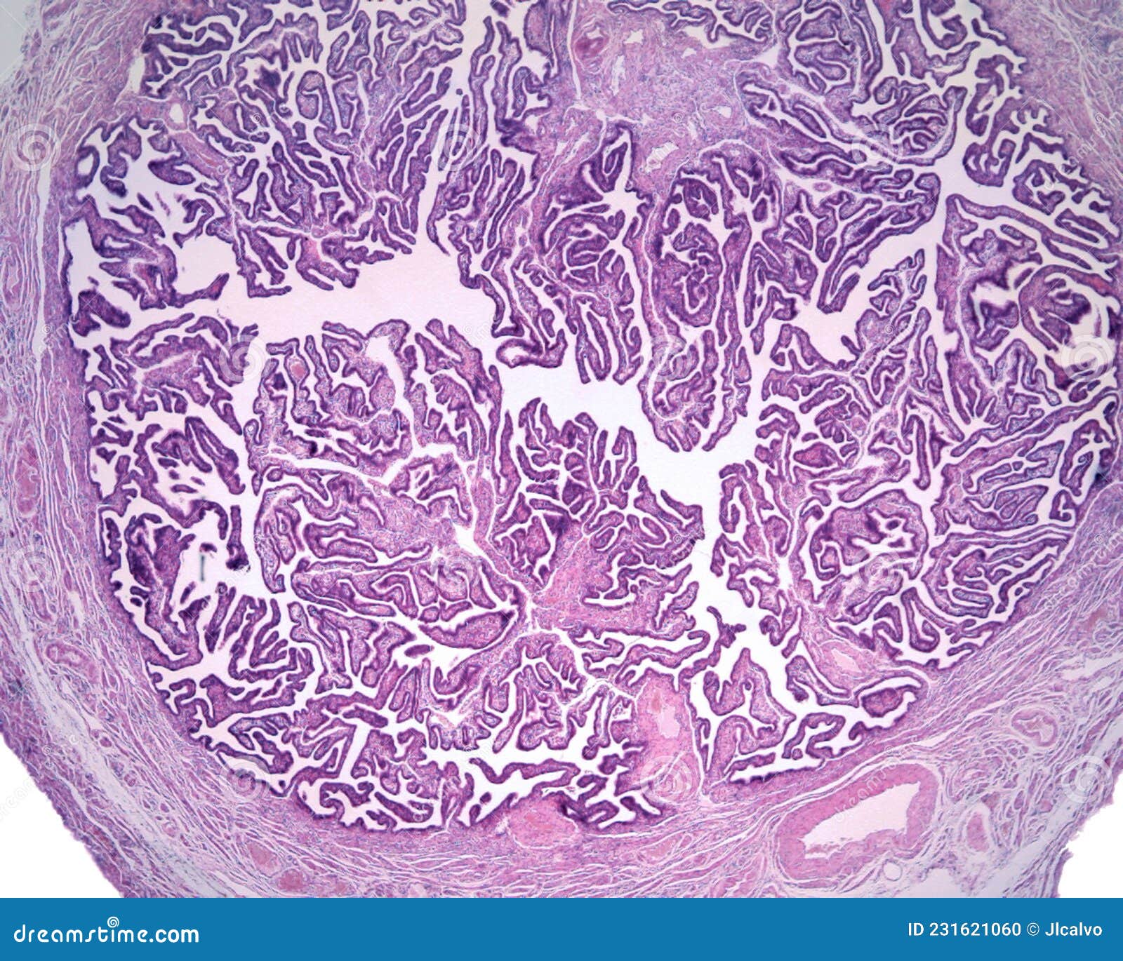 Fallopian Tube Slide