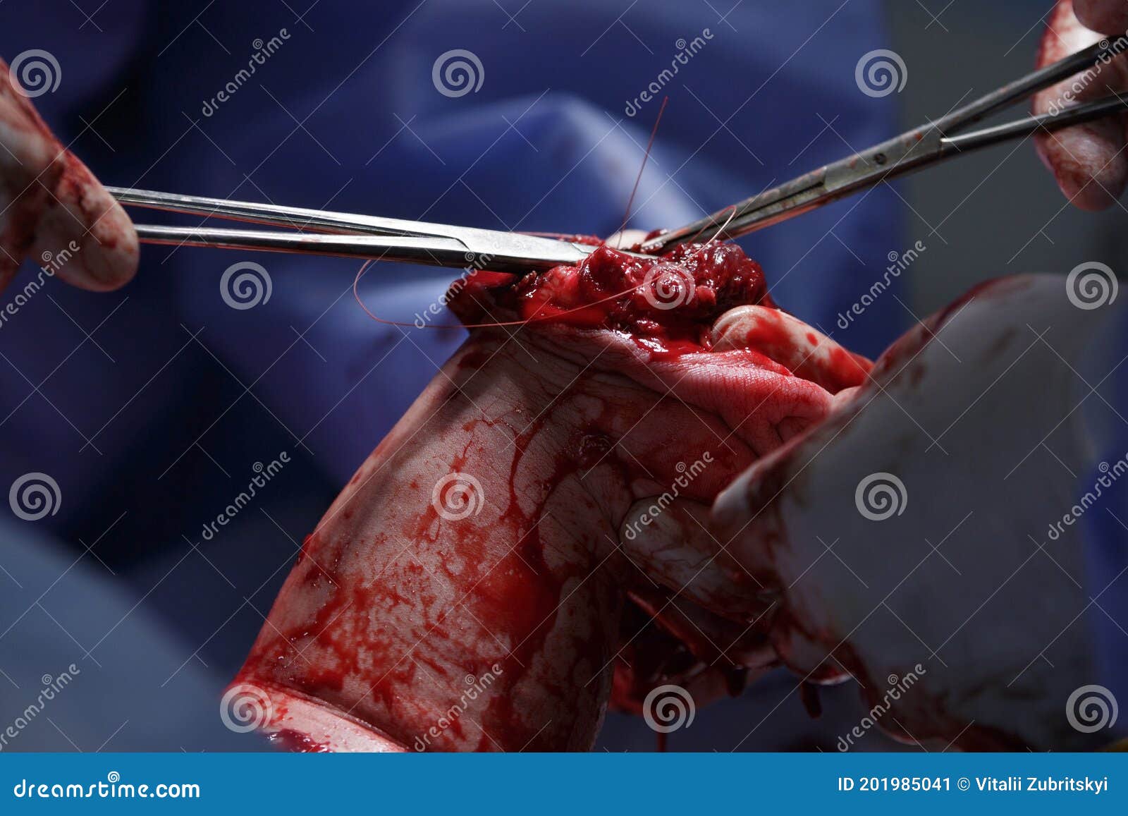 Amputated Hand Sewing Macro Stock Image - Image of closeup, finish ...