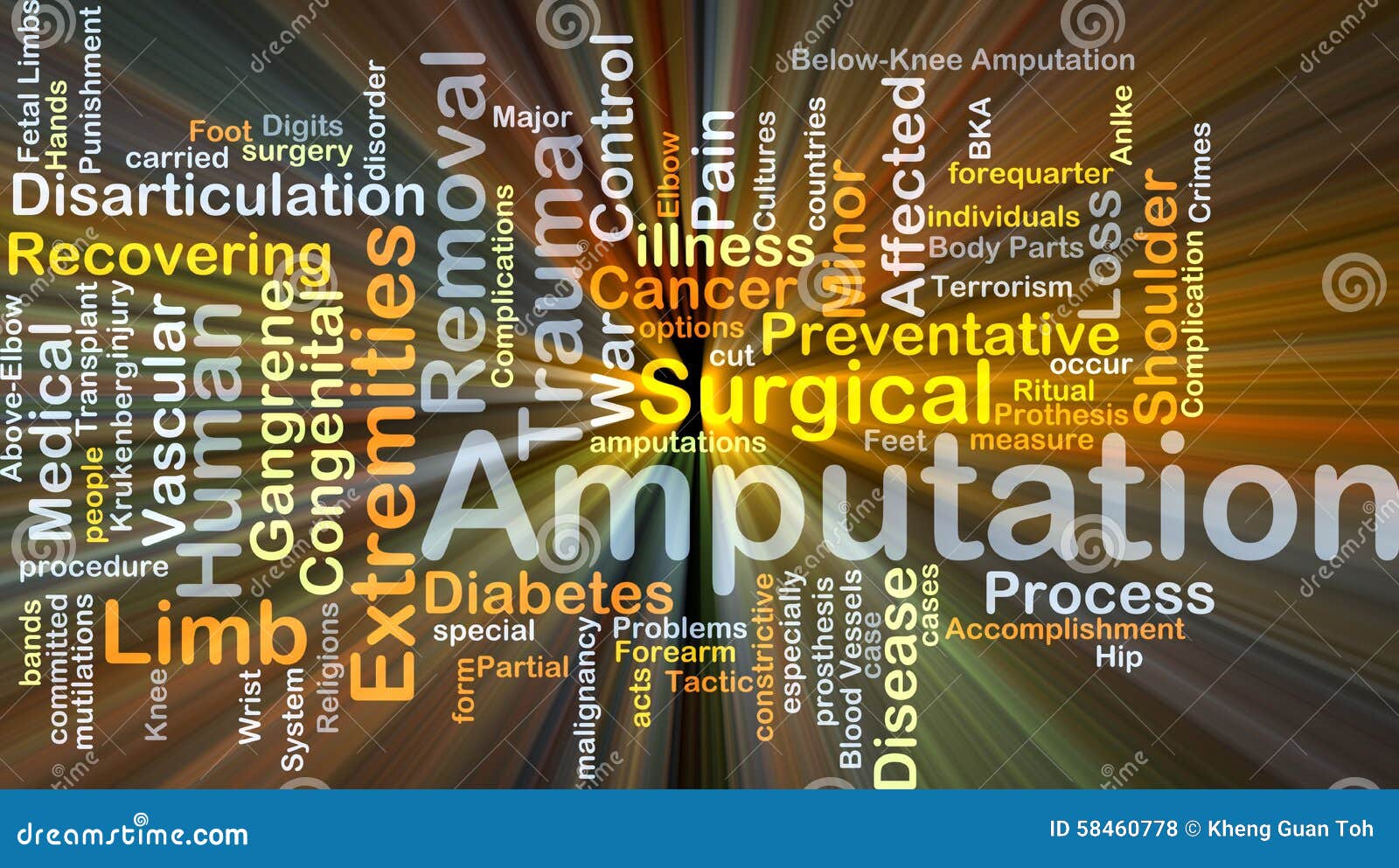 Amputation Background Concept Glowing Stock Illustration - Illustration ...