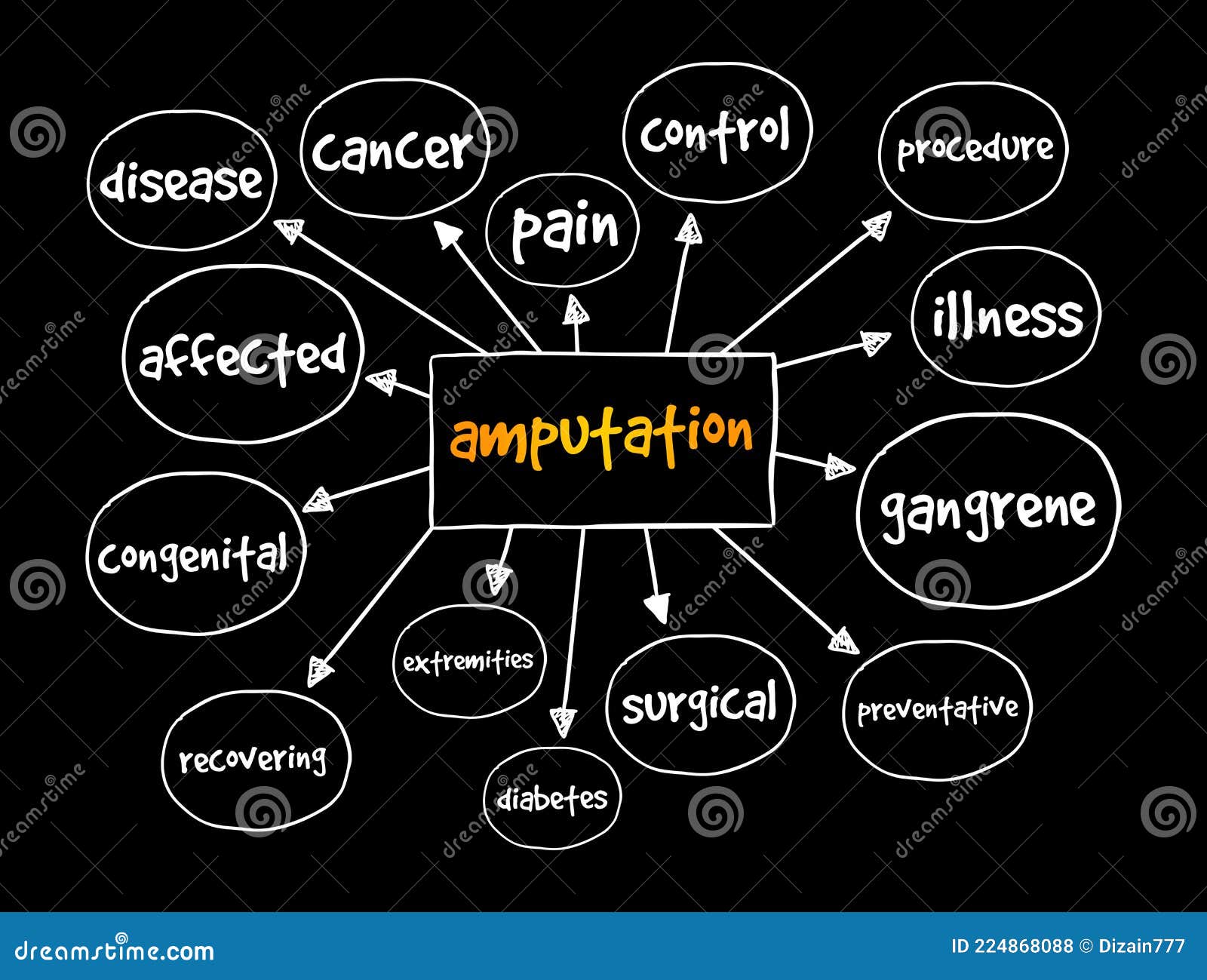 Amputation Mind Map, Medical Concept for Presentations and Reports ...