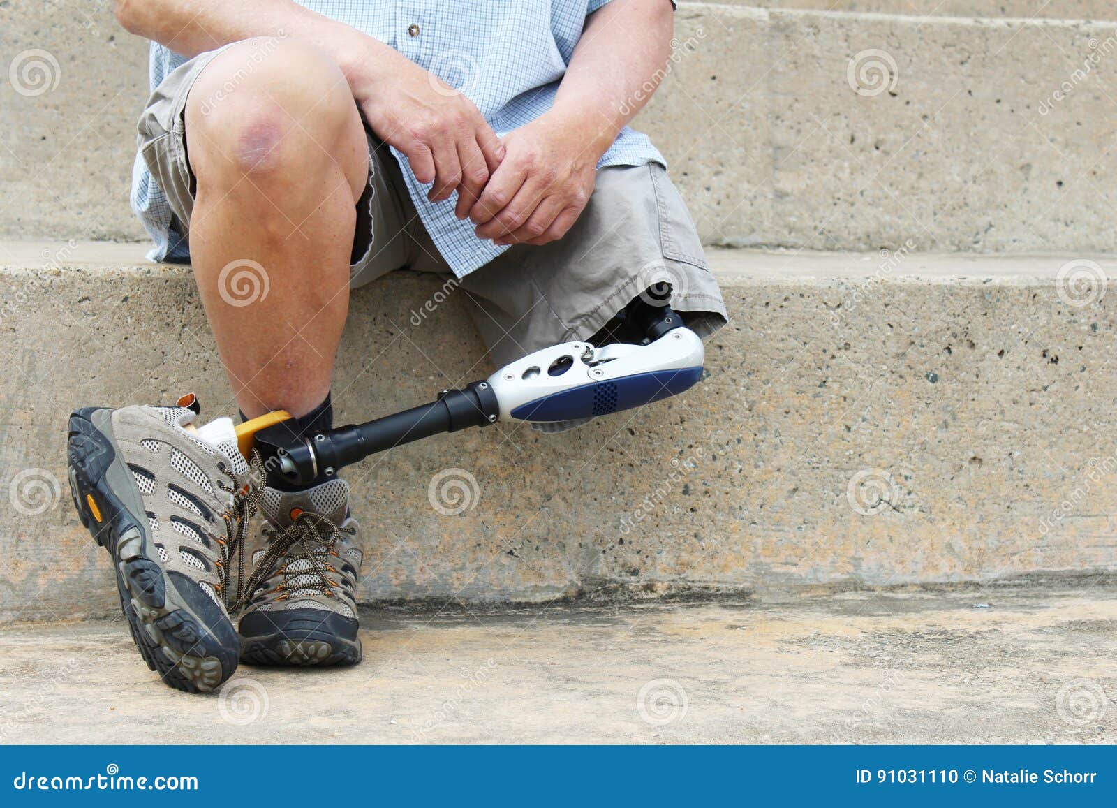 Amputato Con Le Gambe Attraversate Fotografia Stock - Immagine di ...