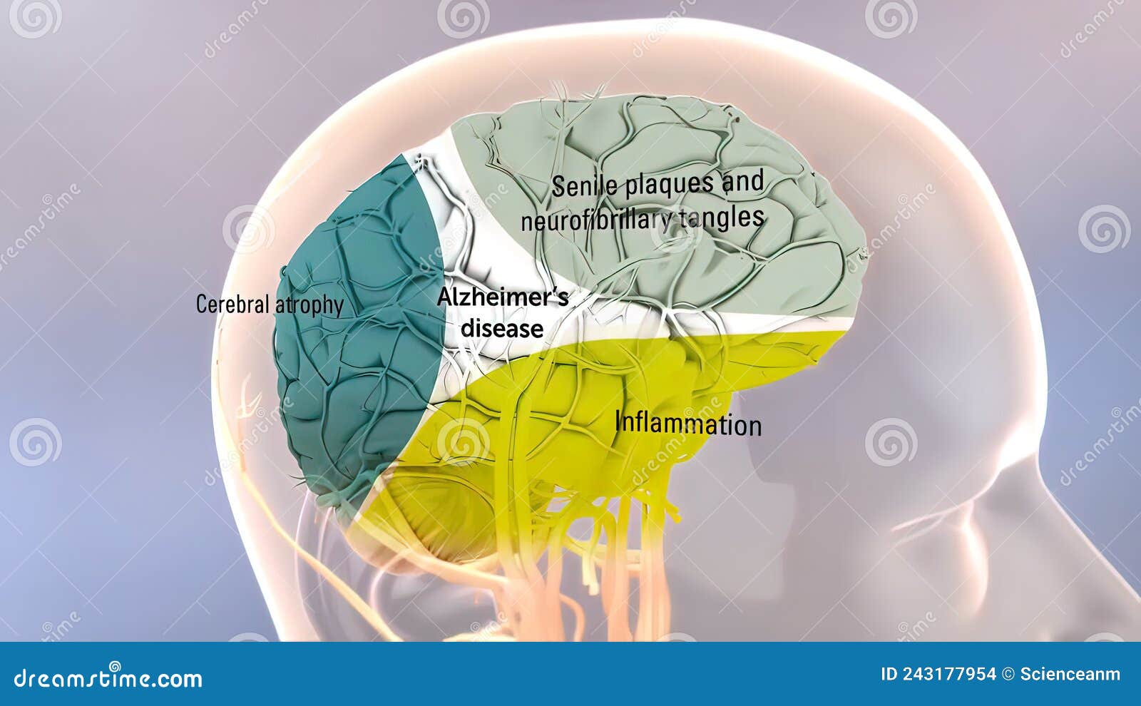 Amyloid Precursor Protein Processing and Alzheimer S Disease Stock ...