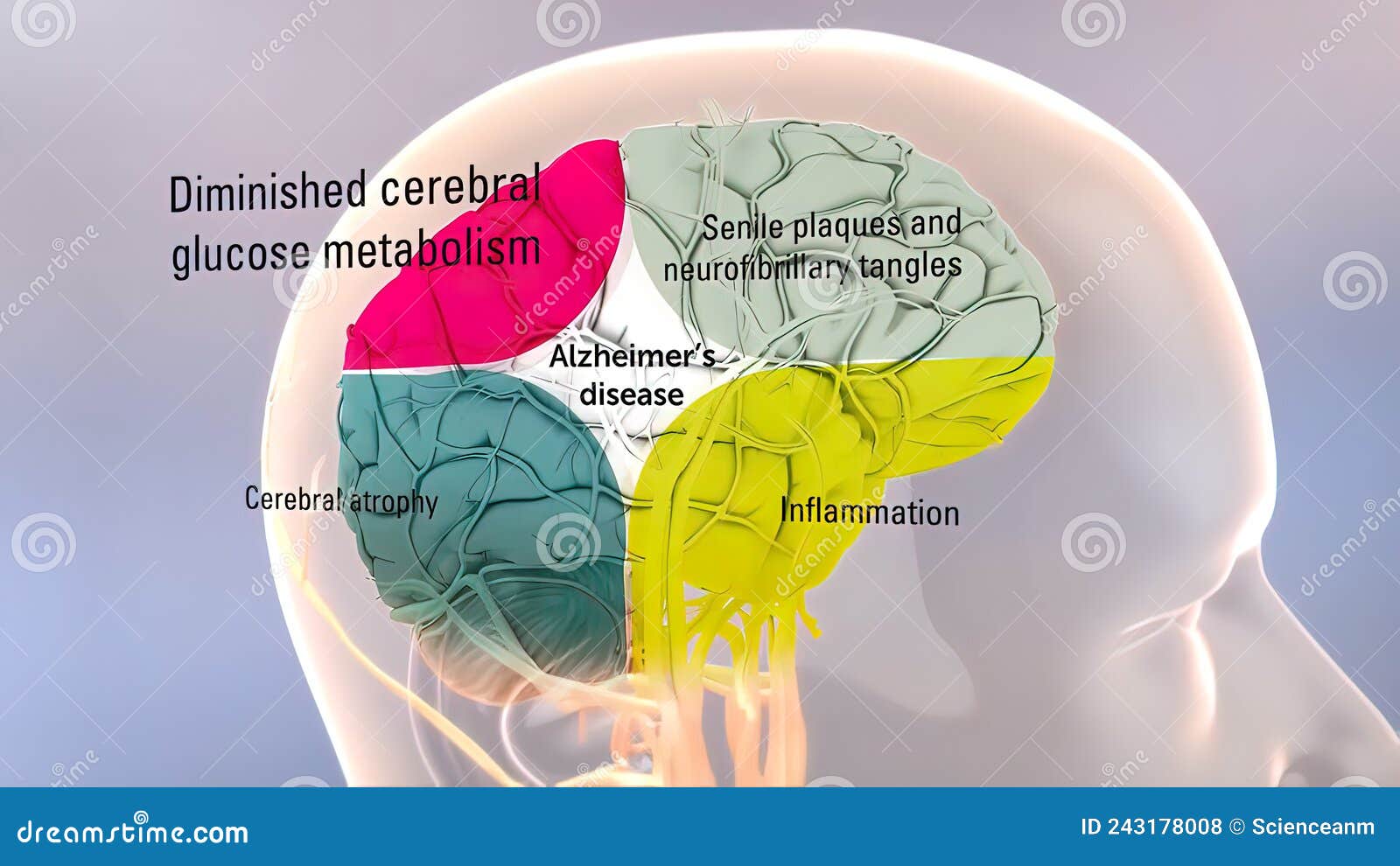 Amyloid Precursor Protein Processing and Alzheimer S Disease Stock ...