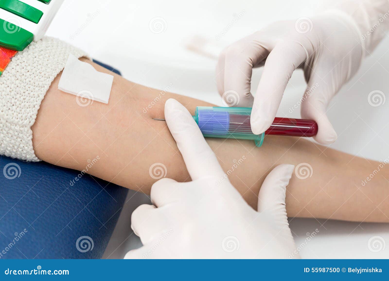 Análisis De Sangre De La Vena Foto de archivo - Imagen de azul, brazo ...