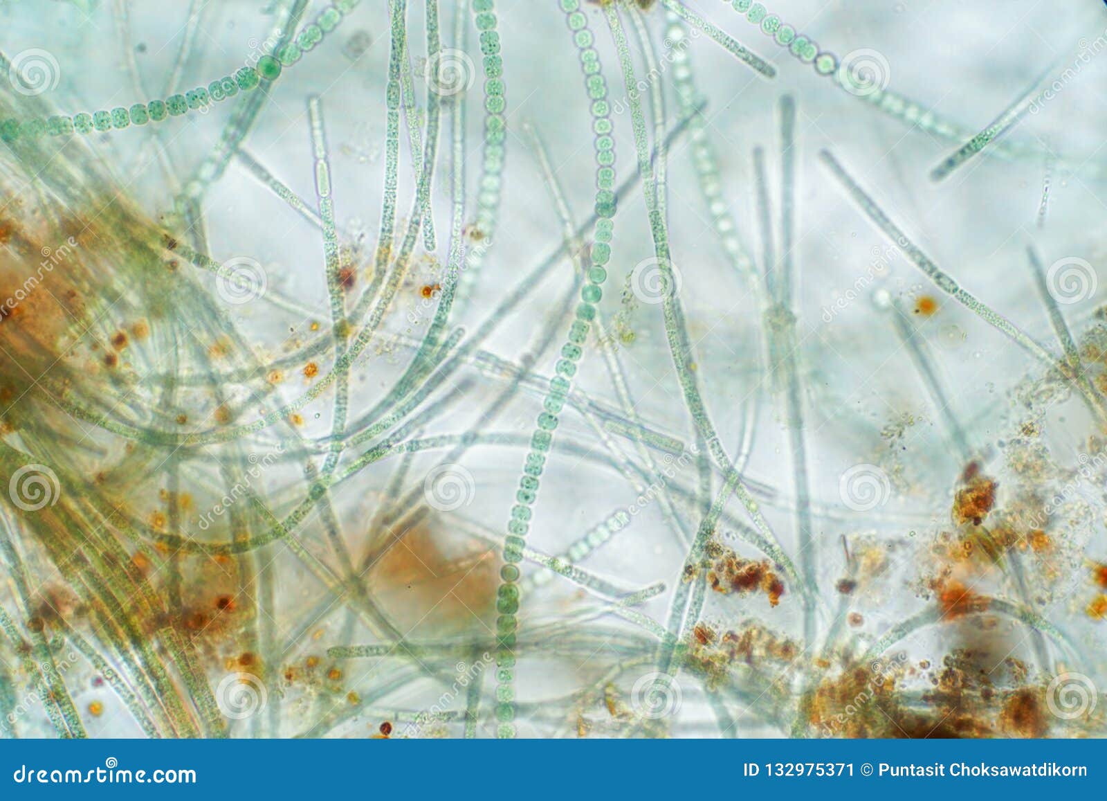 Anabaena is a Type of Algae Under the Microscopic Stock Image - Image ...