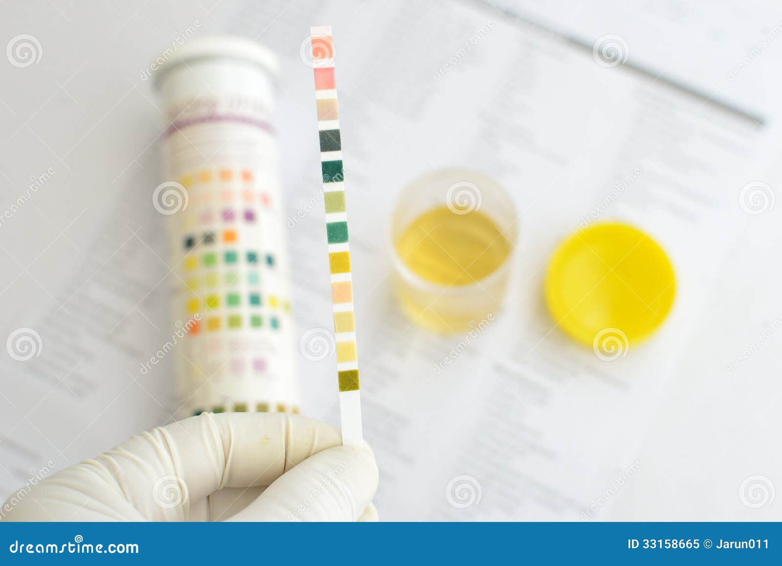 Analyse d'urine image stock. Image du science, chimie - 33158665