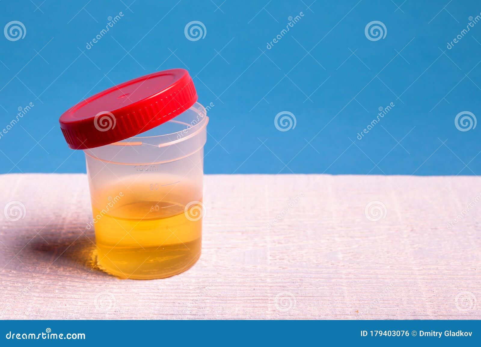 Analyse D'urine Pour Un Essai Dans Un Pot En Plastique Photo stock ... Analyse D'urine Pour Un Essai Dans Un Pot En Plastique Photo stock ...