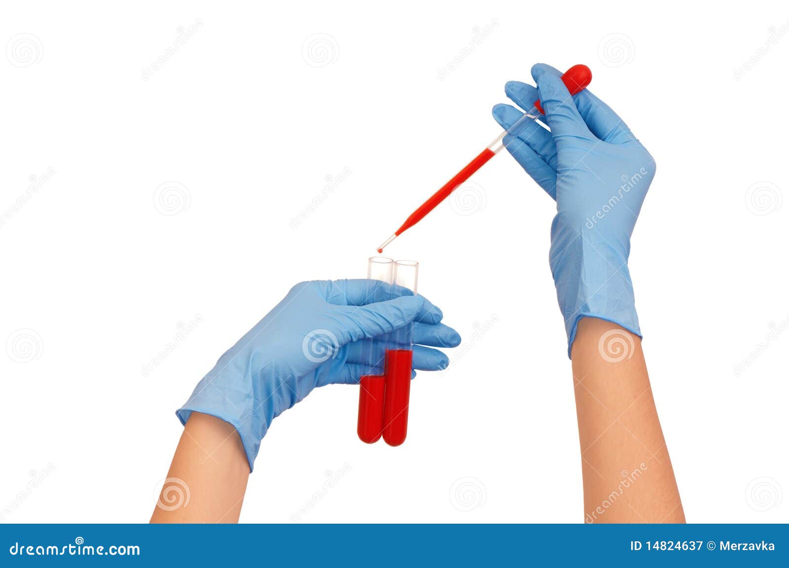 Comment Lire Son Analyse De Sang - Santé Magazine - Revision