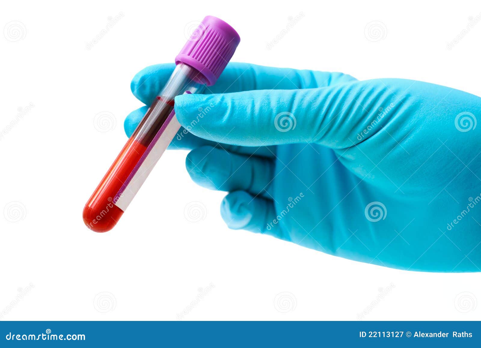 Analyse de sang image stock. Image du matériel, biochimie - 22113127