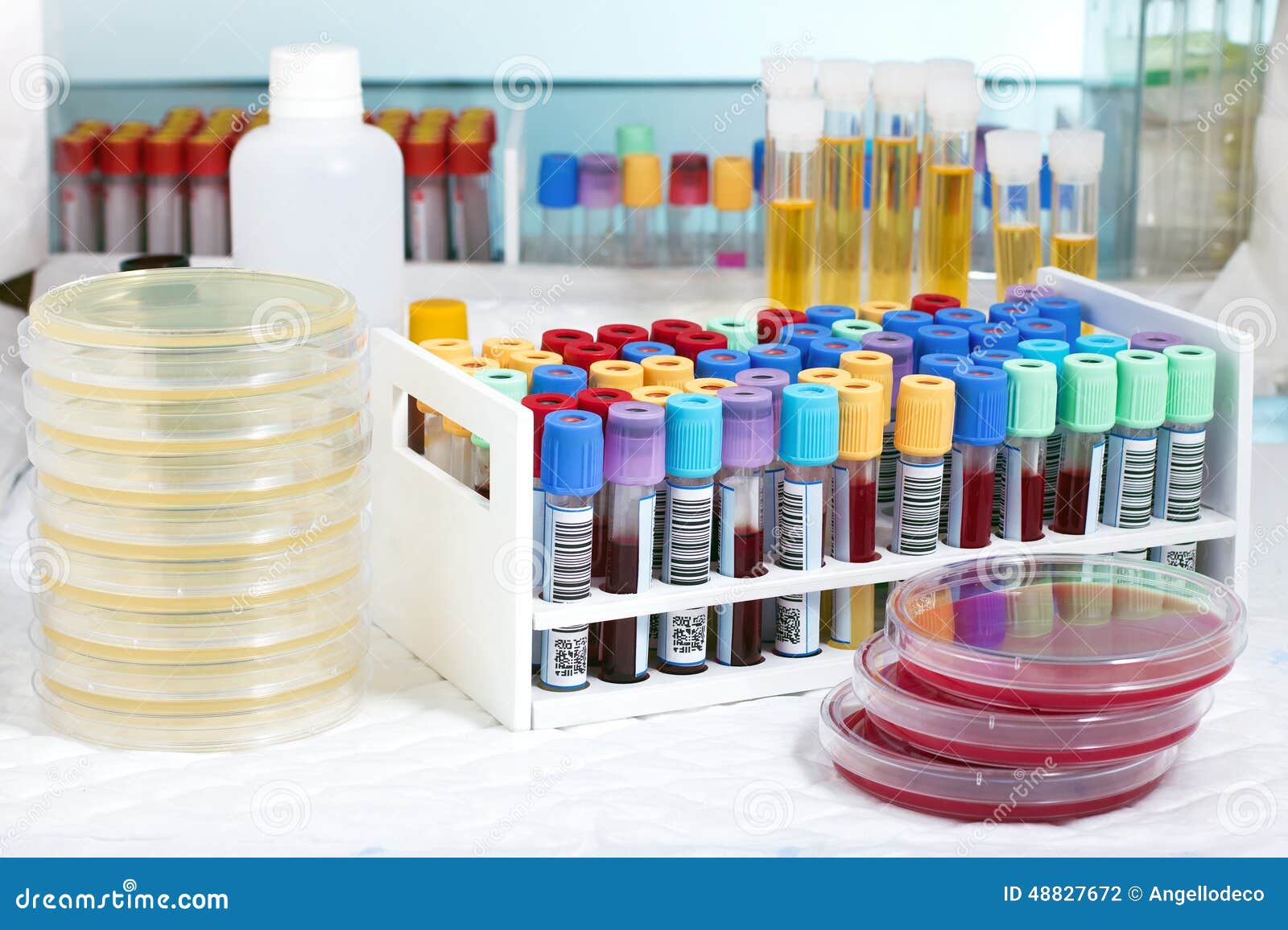 Analyse Van Bloedbuizen in Laboratorium Stock Foto - Image of houder ...