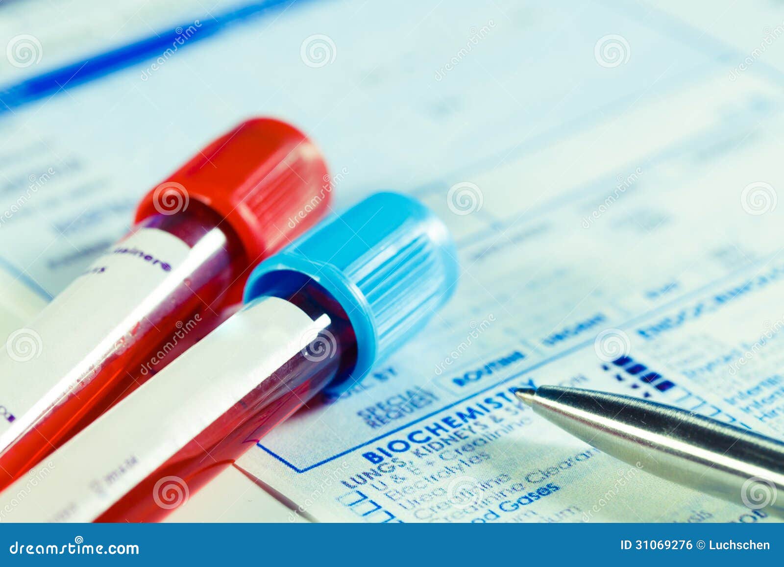 Analyses De Sang De Biochimie Photo stock - Image du sang, rouge: 31069276