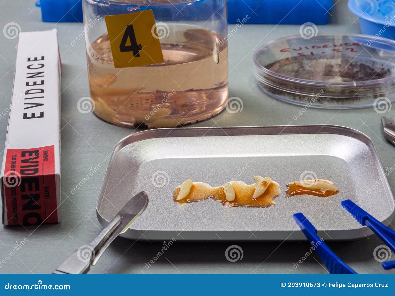 Analysis of Larvae from Corpse Involved in Murder in Crime Lab Stock ...