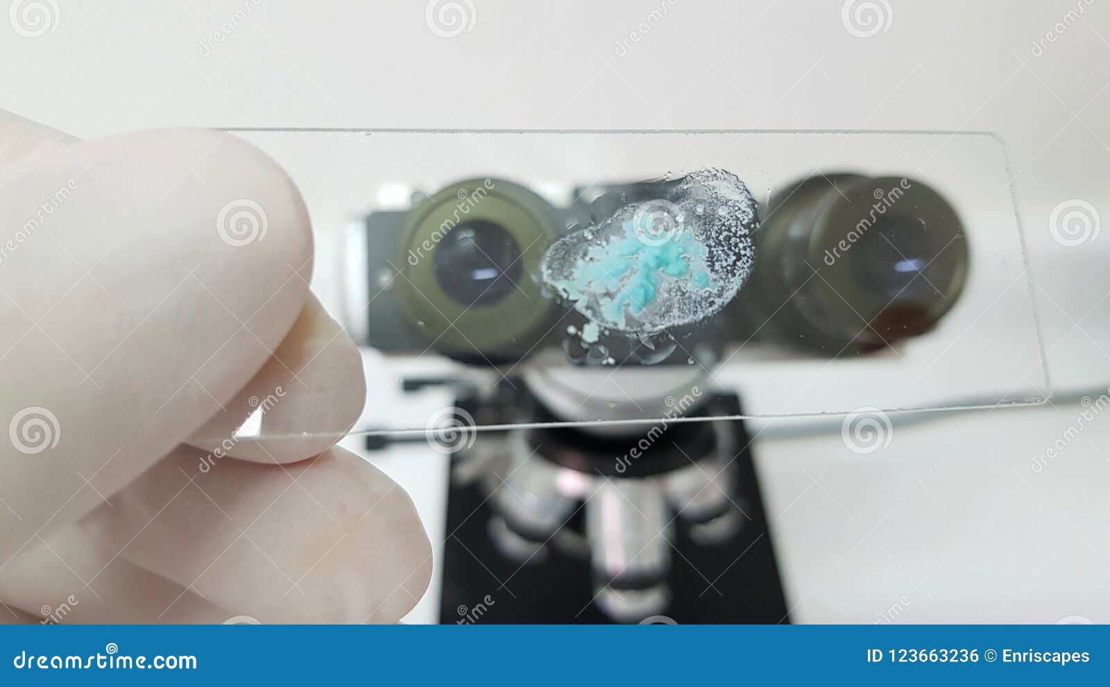 Analysis of Microbiological Sample Stock Photo - Image of discovery ...
