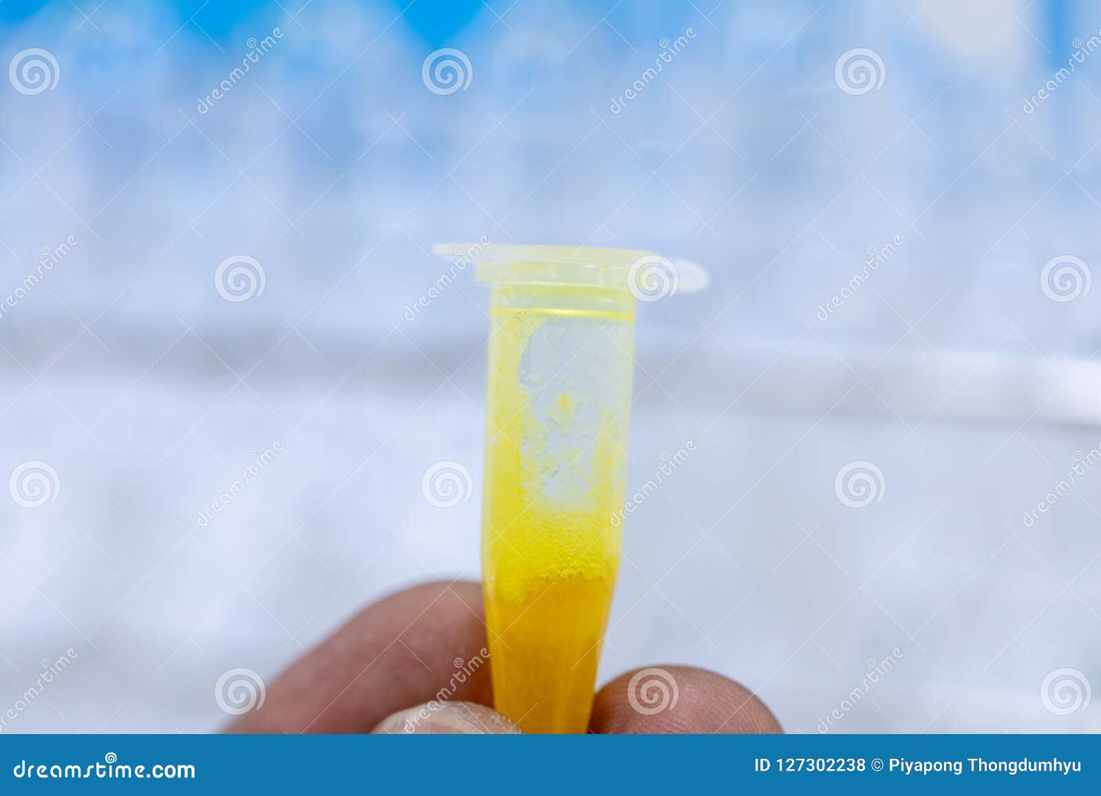 Analysis Protein for Study in Laboratory. Stock Photo - Image of ...