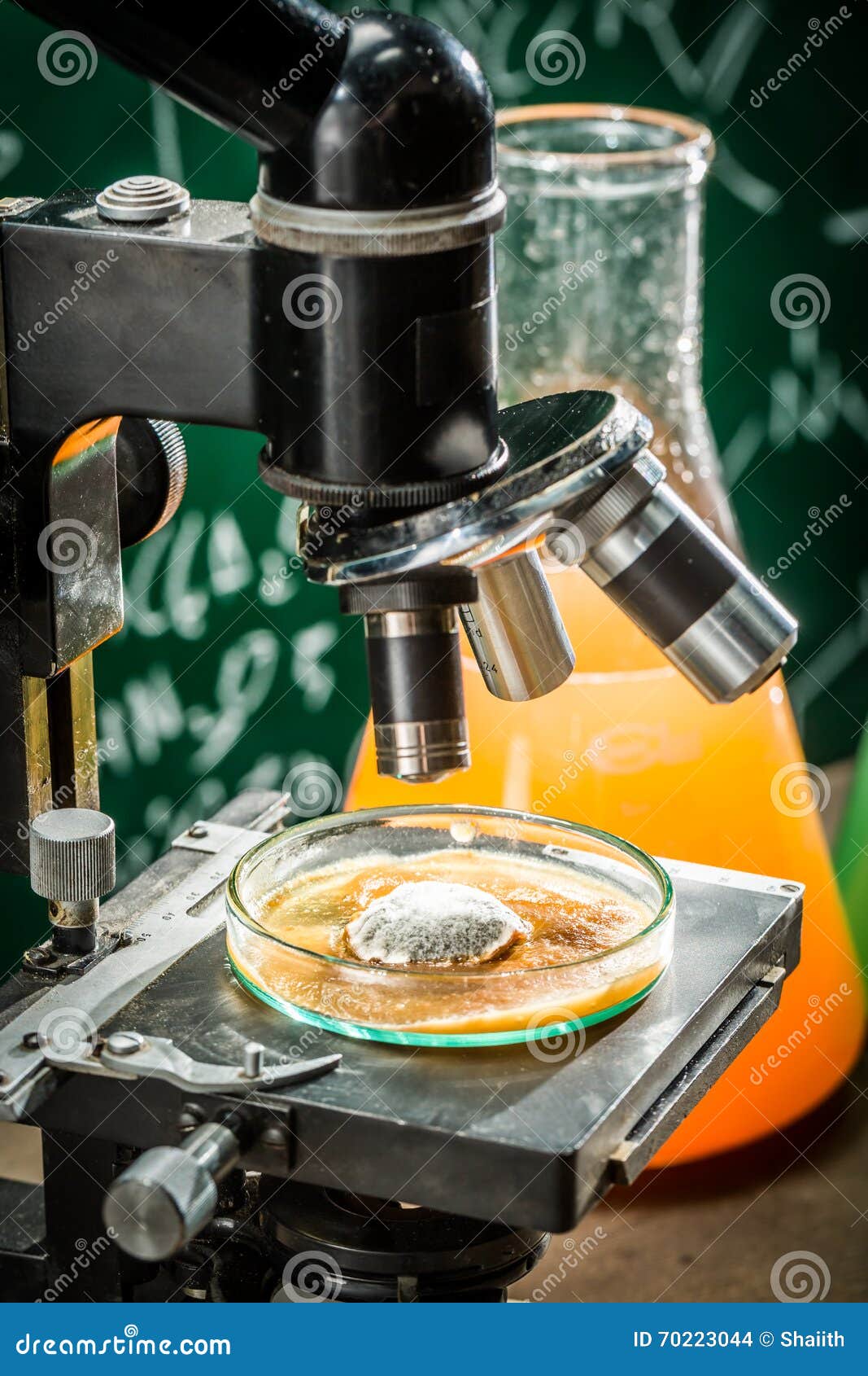 Analyzing Mold in the Chemical Laboratory Stock Photo - Image of ...