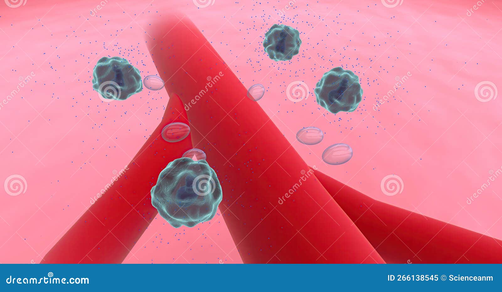Anaphylaxis, Histamine Release and Vascular Edema Stock Illustration ...