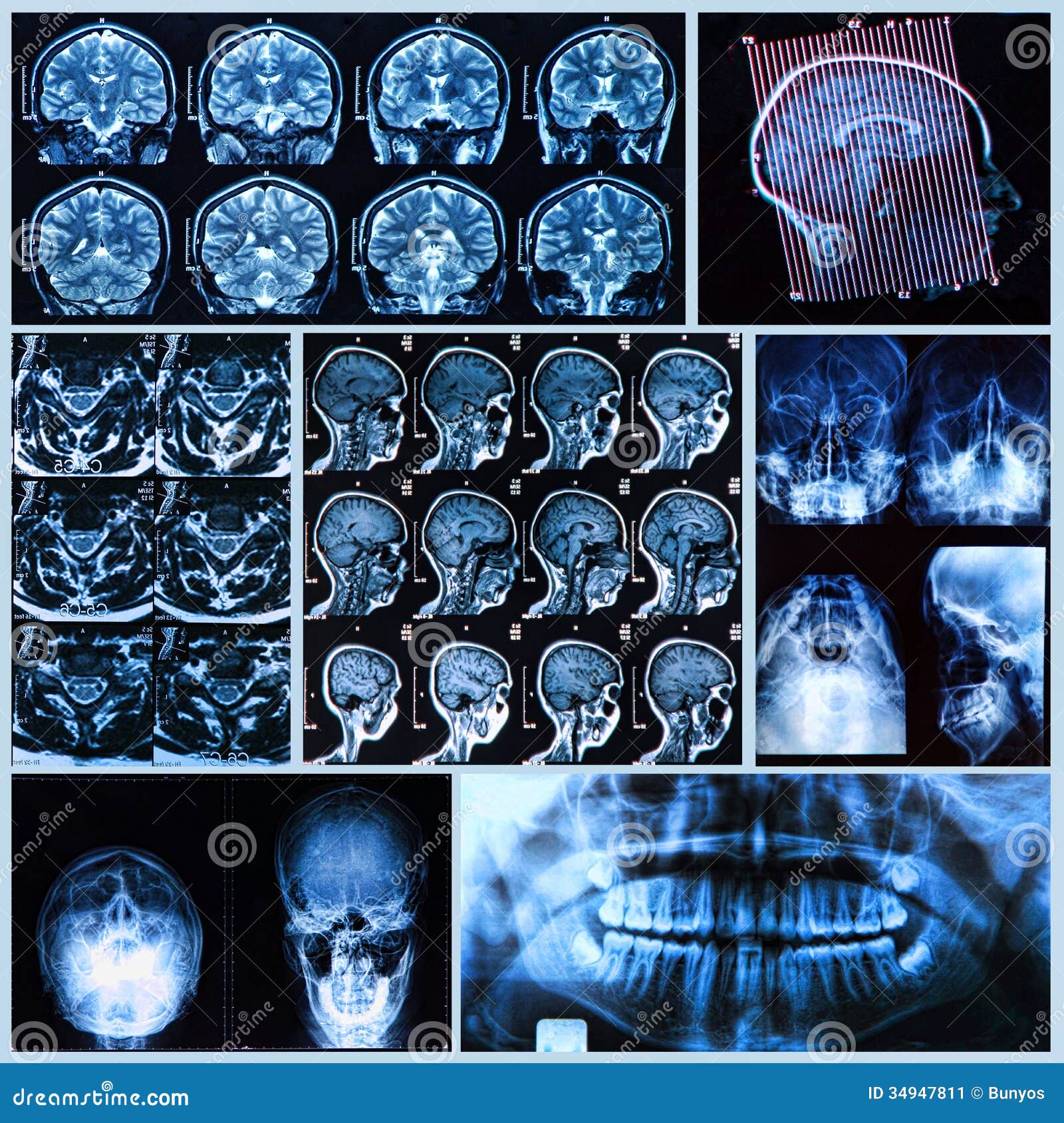 Anatomía De La Cabeza Y Del Cuello Imagen de archivo - Imagen de ...