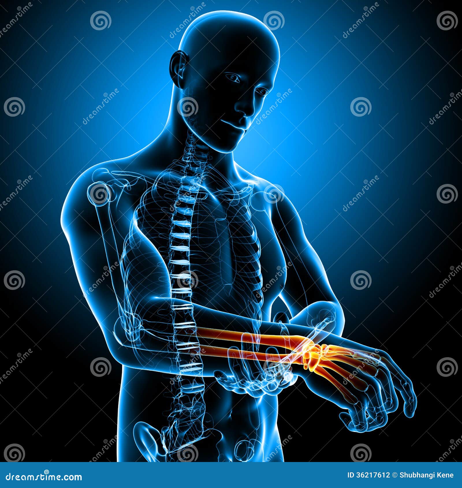 Anatomia Da Dor Masculina Do Pulso Ilustração Stock - Ilustração de ...