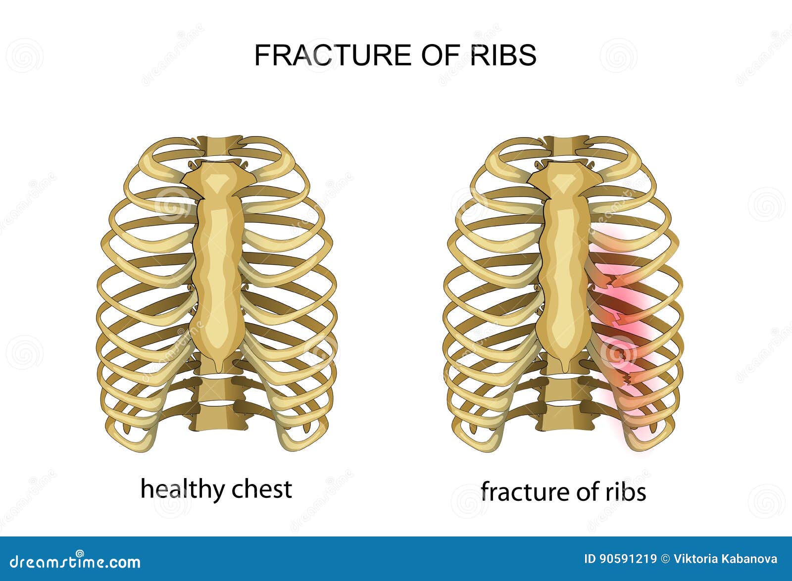 Anatomia del torace illustrazione vettoriale. Illustrazione di umano ...