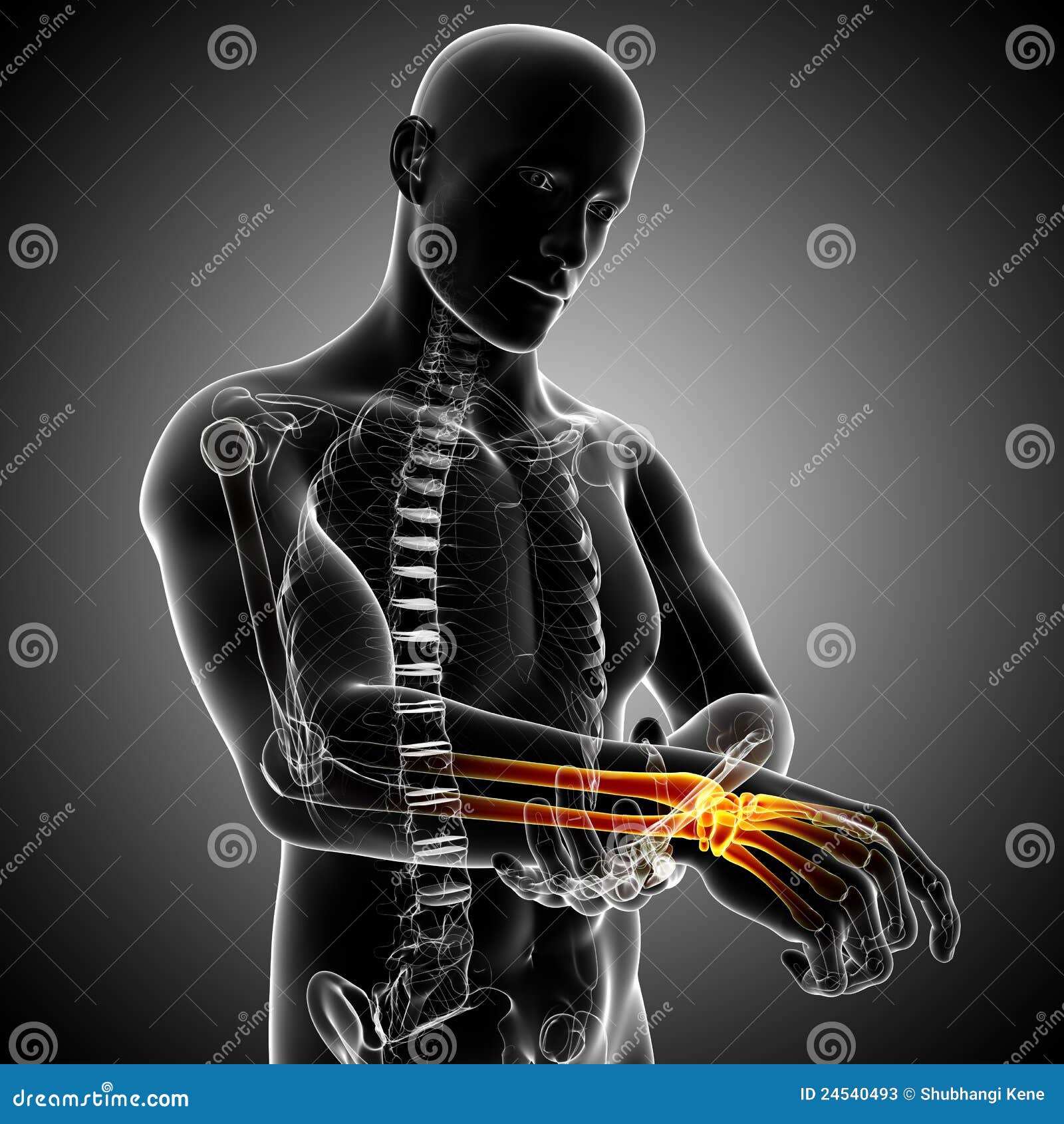 Anatomia Di Dolore Della Mano Illustrazione di Stock - Illustrazione di ...