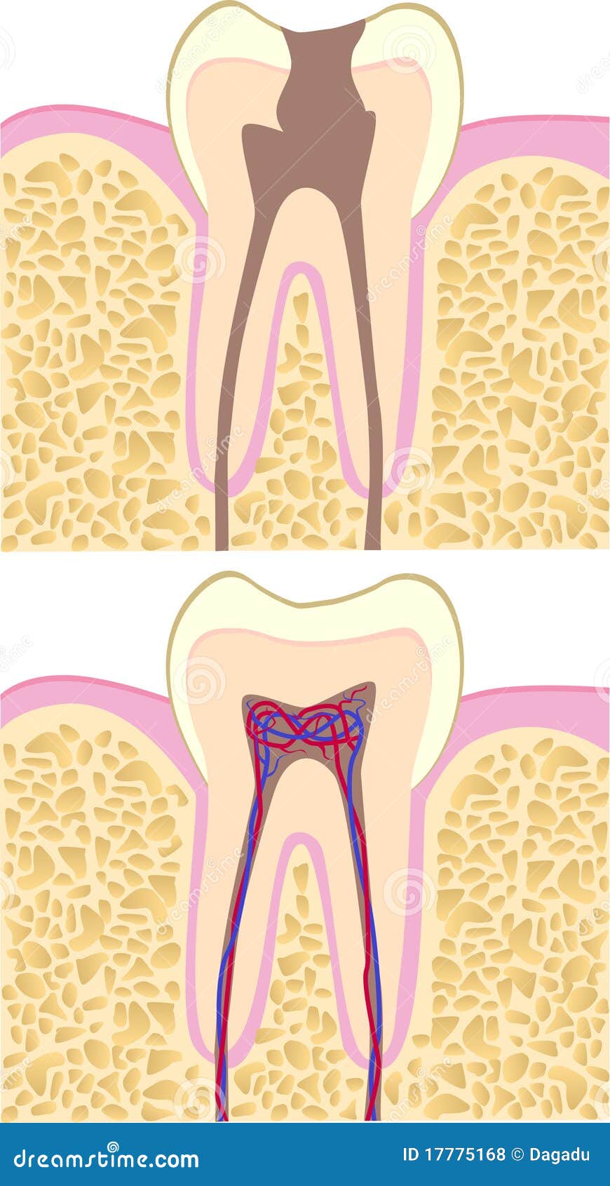 Anatomia do dente ilustração do vetor. Ilustração de corpo - 17775168