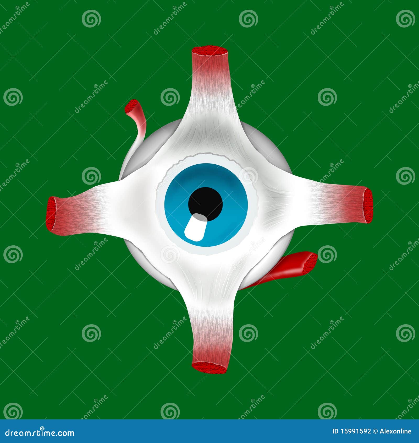 Anatomic Illustration Of A Hysteroscopic Procedure. Inspection Of The ...