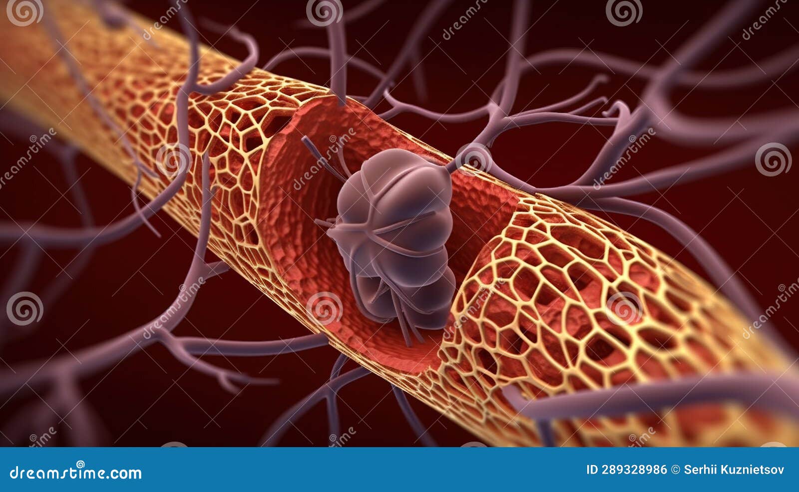 BOARD Venous Plexuses Of The Vertebral Canal Stock Photo ... BOARD Venous Plexuses Of The Vertebral Canal Stock Photo ...