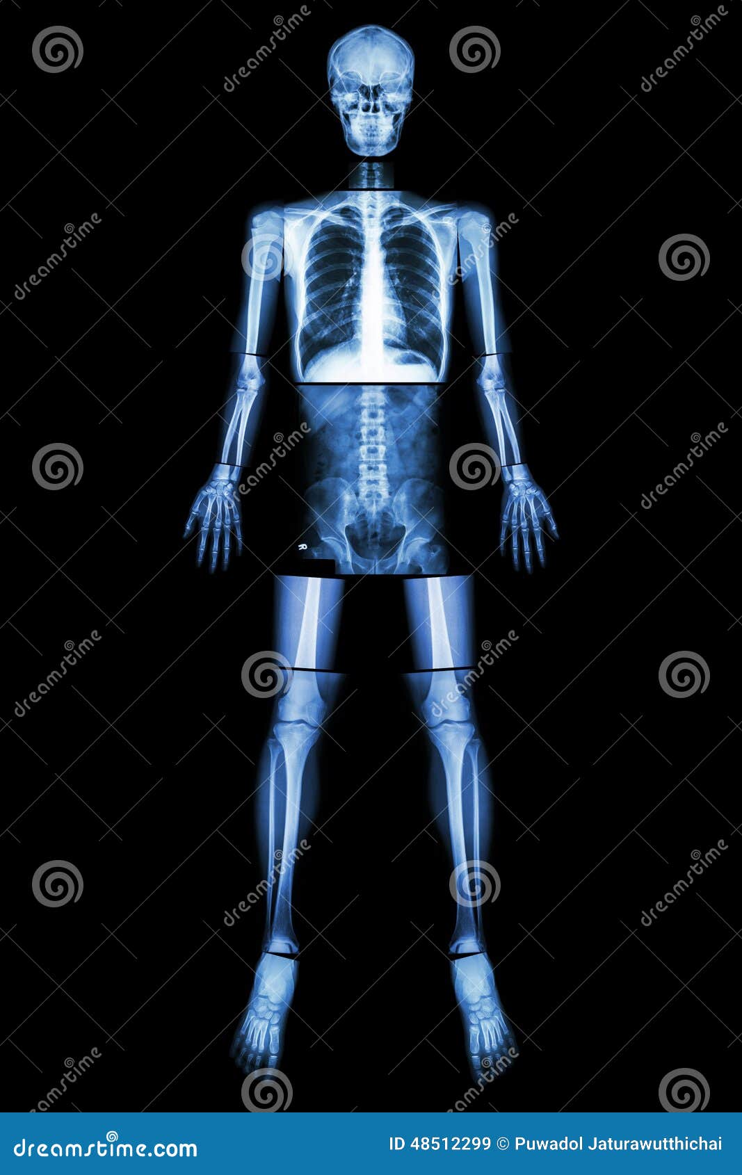 Anatomical Position. (X-ray Whole Body ) Stock Image - Image of heel ...