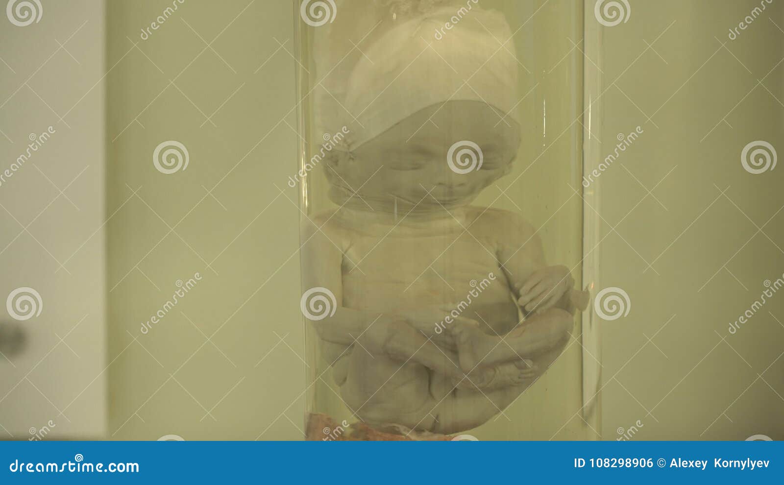 Anatomical Human Specimens In Formalin Editorial Photo Image Of Organ Head 108298906
