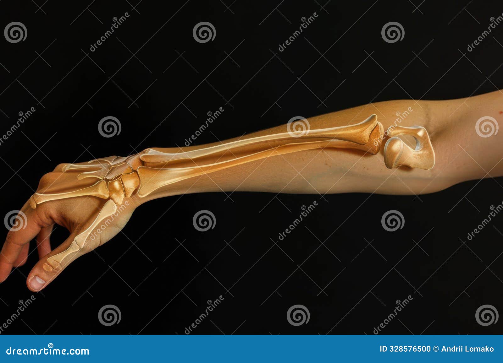 Detailed Anatomy Model of a Human Arm with Visible Bones in Educational ...