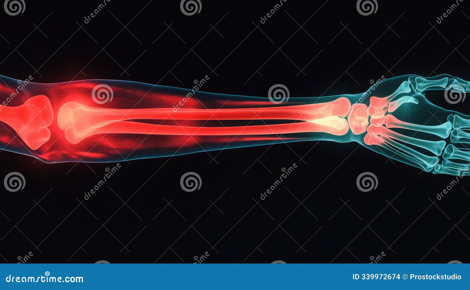Visualization of a Human Forearm with Highlighted Bones and Muscles for ...