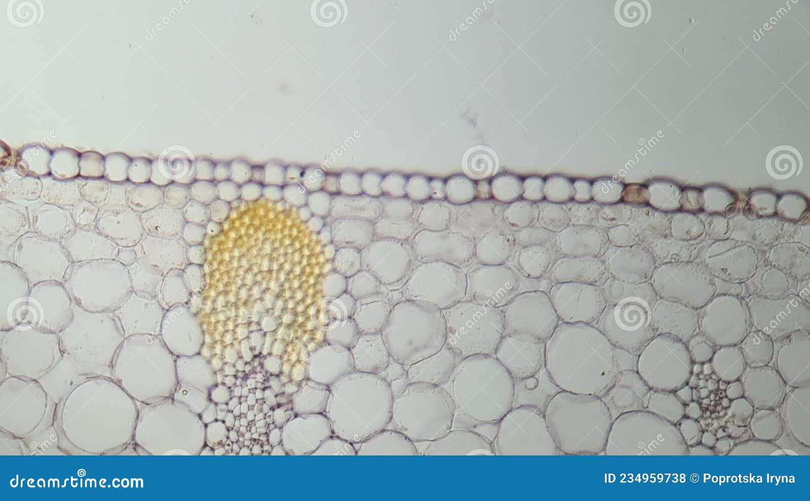 Tissues Of Iris Root, Microscopical Structure Royalty-Free Stock Image ...