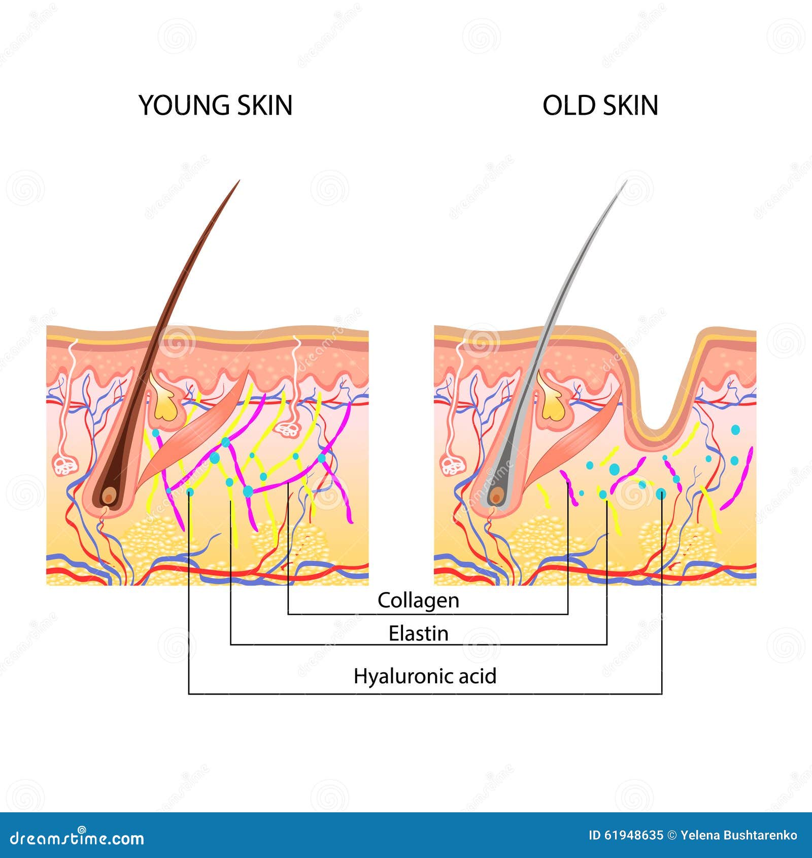 Structure Of The Skin Glyph Black Icon. Hair Anatomy And Hair Follicle ...