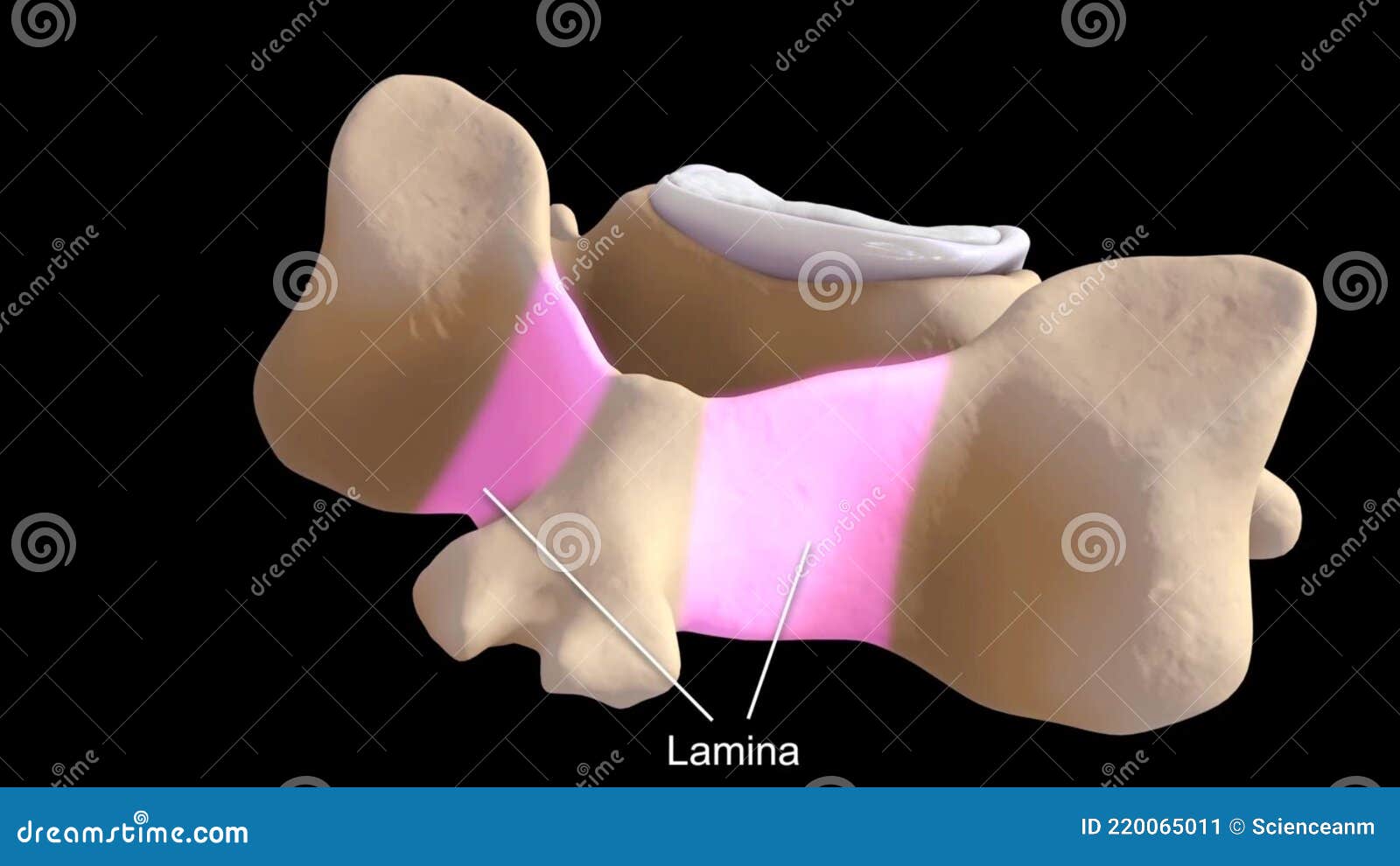 Anatomically Correct 3d View of Intervertebral Disc Cervical Spine ...