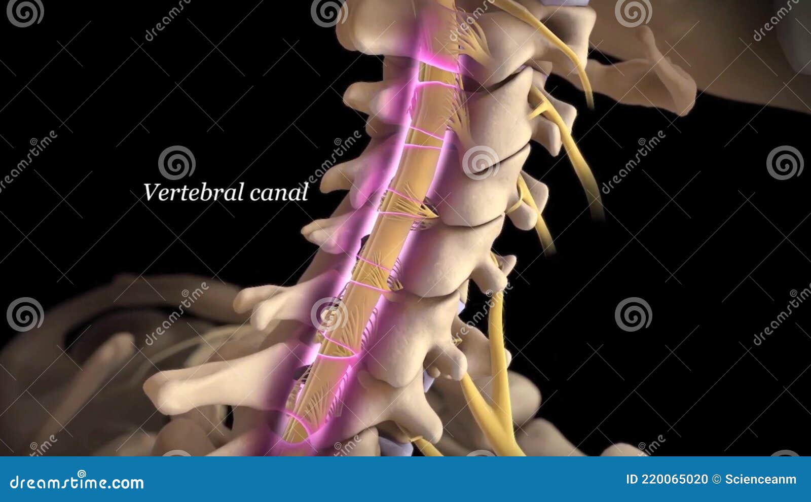 Anatomically Correct 3d View of Intervertebral Disc Cervical Spine ...