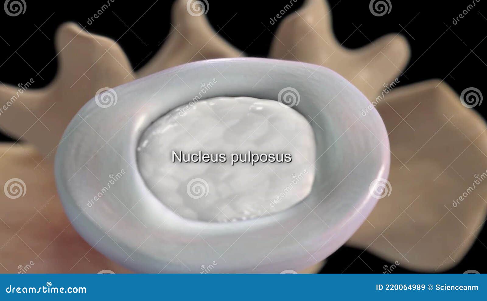 Anatomically Correct 3d of Intervertebral Disc Cervical Spine -nucleus ...