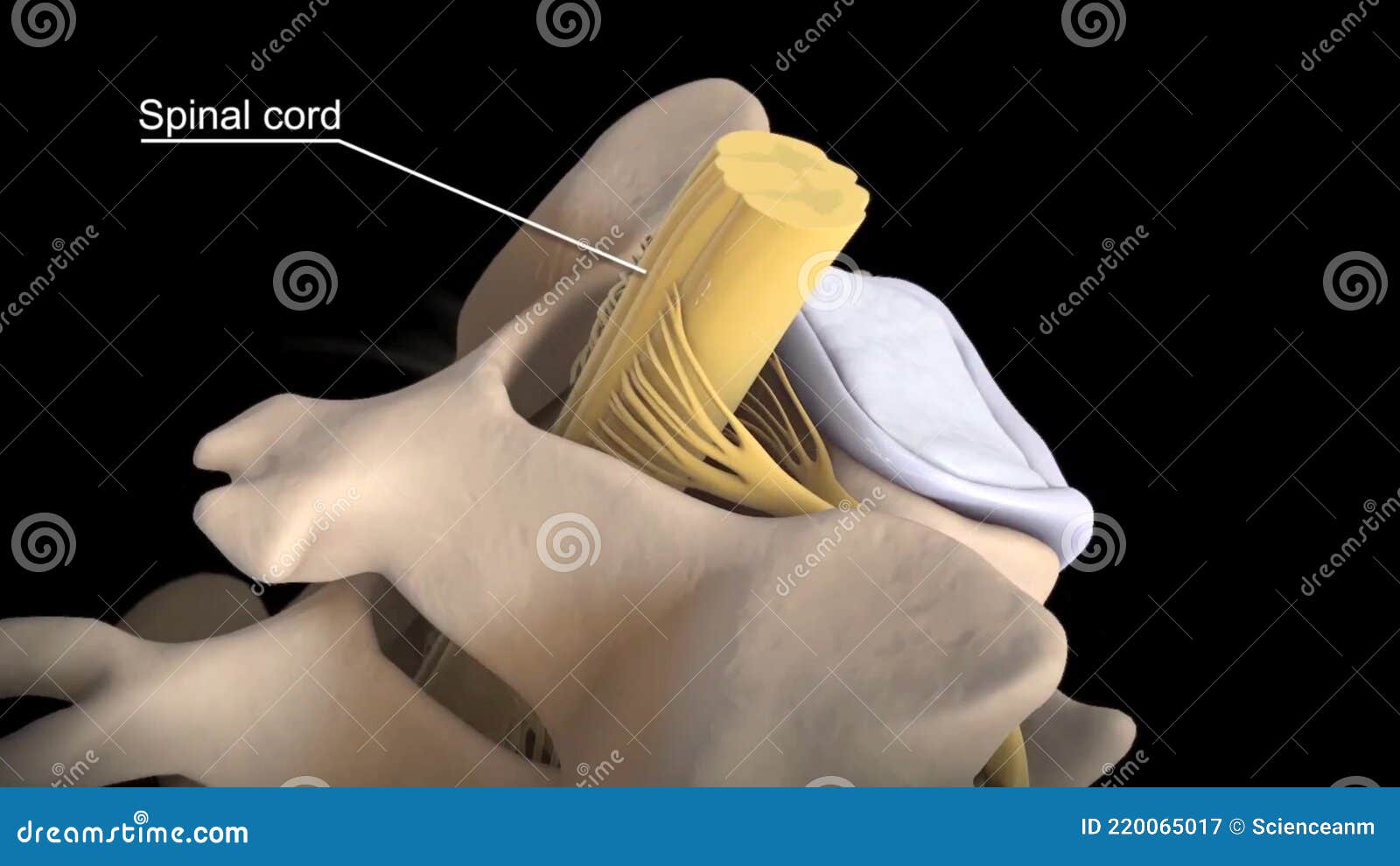Anatomically Correct 3d of Intervertebral Disc Cervical Spine -spinal ...