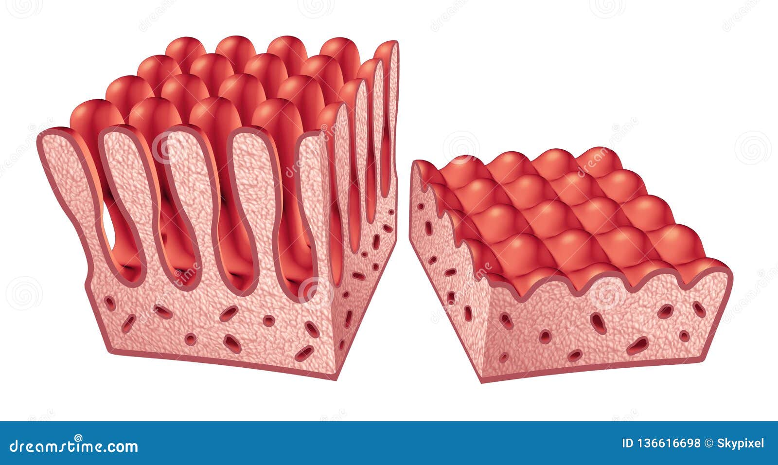 Anatomie De Maladie Coeliaque Illustration Stock - Illustration du ...